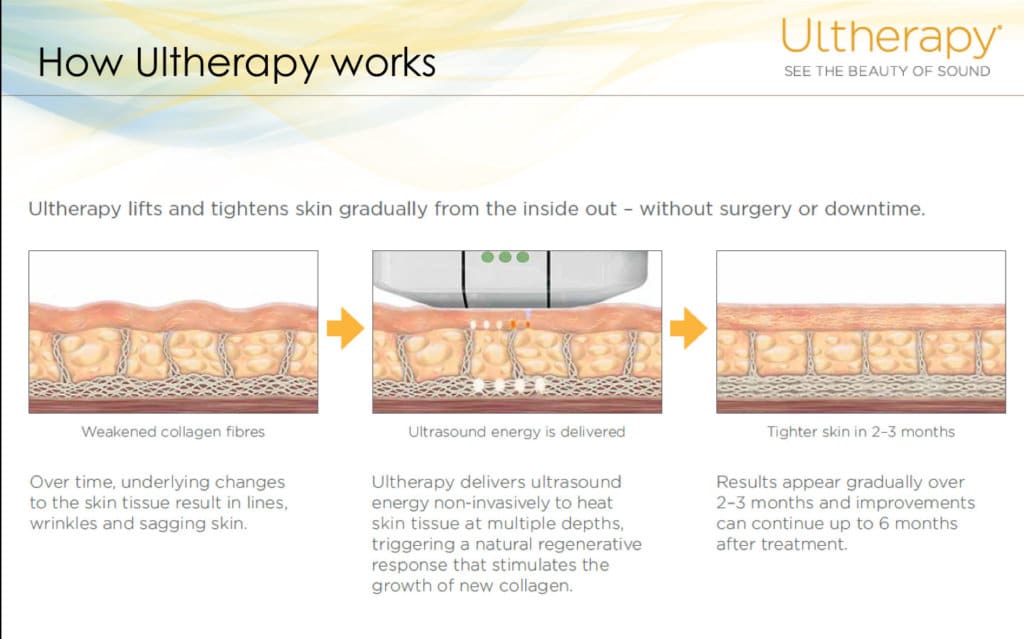 Technology - Lumière Cosmetic Clinic